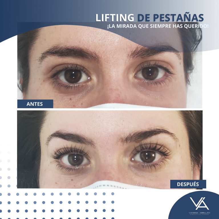 Lifting de pestañas